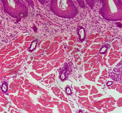 Microscopy Techniques - Fluorescent Microscope, Phase Contrast ...